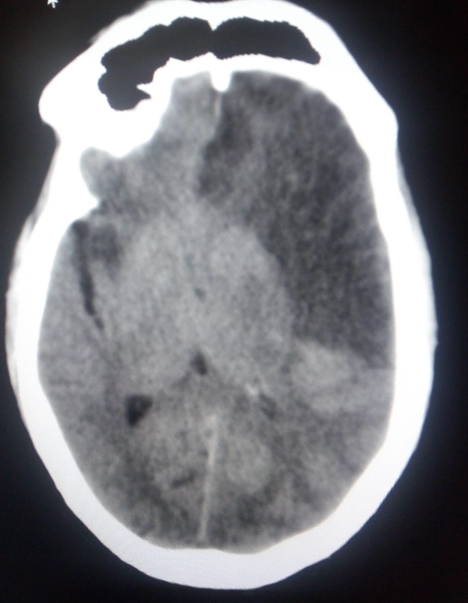 Snake Bite and Radiology - Sumer's Radiology Blog