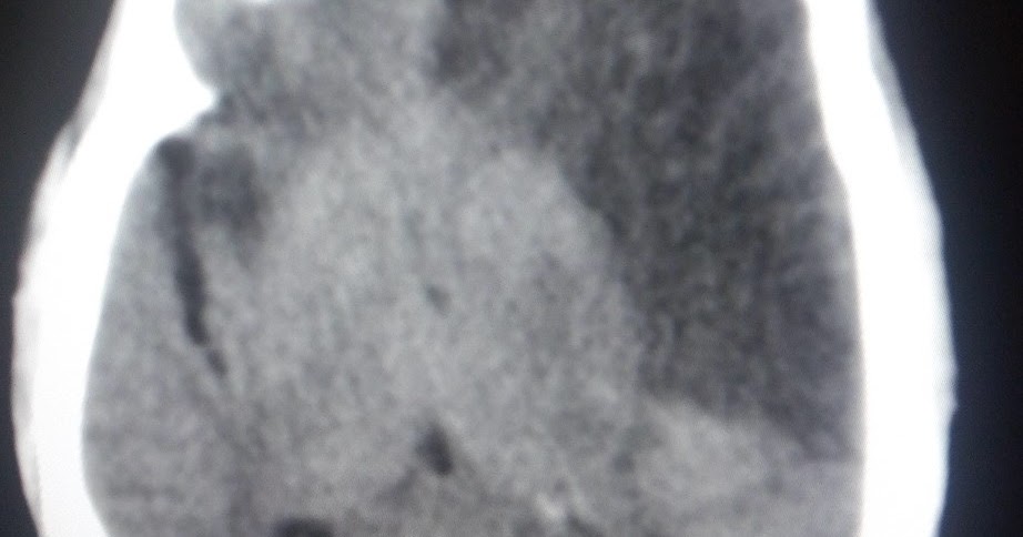 Snake Bite and Radiology - Sumer's Radiology Blog