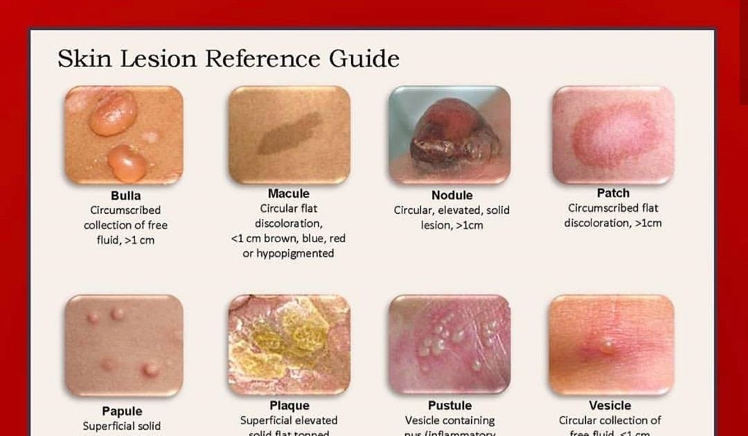 EMS SOLUTIONS INTERNATIONAL by @DrRamonReyesMD marca registrada: Skin ...