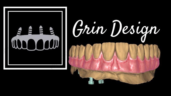 Arquivos EXOCAD para Download