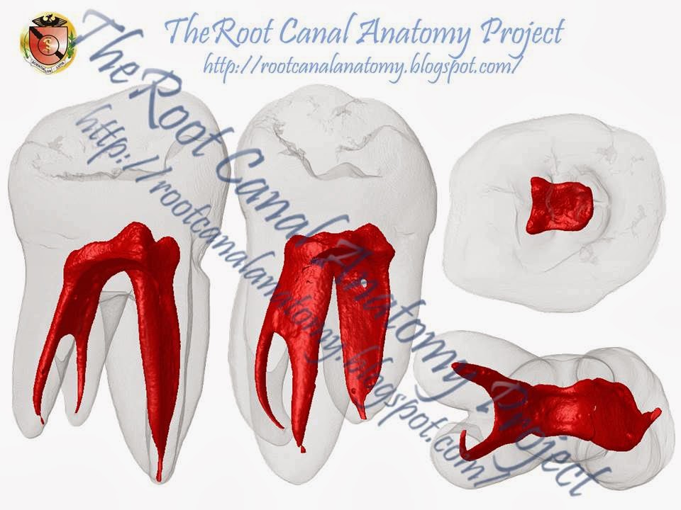 The Root Canal Anatomy Project: Mandibular Second Molar