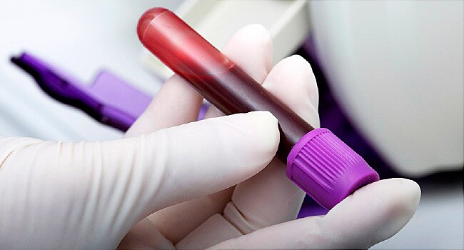 StayGate: Non-invasive blood test can detect cancer 4 years in advance