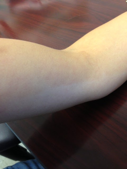 It Freezes Beautifully: 7 Quick Takes {10} - Self Tanning Disasters