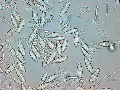 Fun With Microbiology (What's Buggin' You?): Microsporum canis