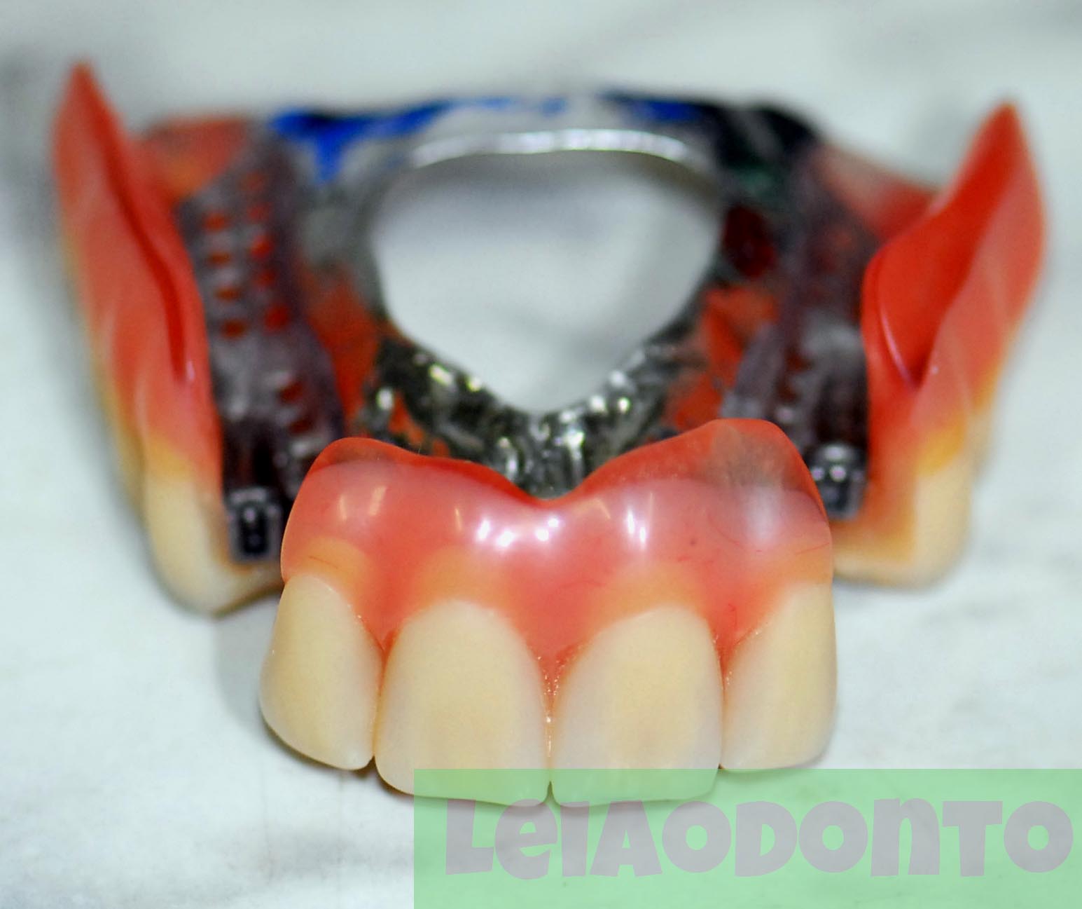 da PPR em modelo de gesso.