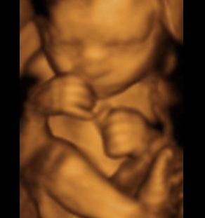 A Whole Nine Months: Today: 25 Weeks