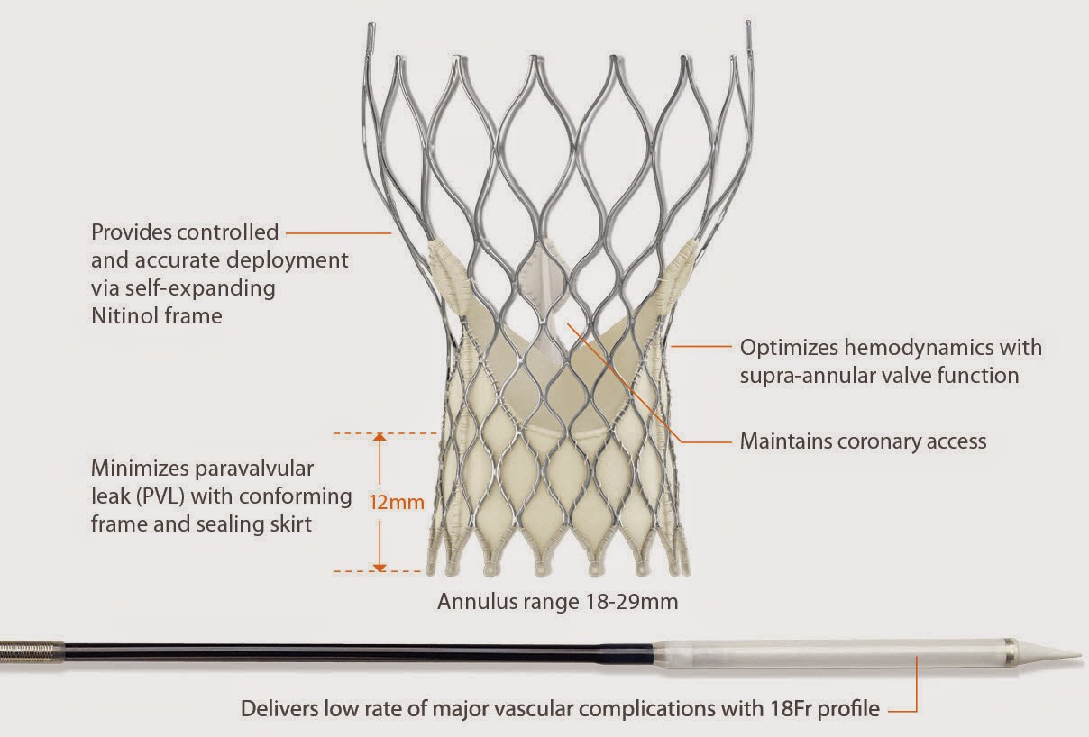 Interventional Medical Devices: The Advanced Design of TAVI
