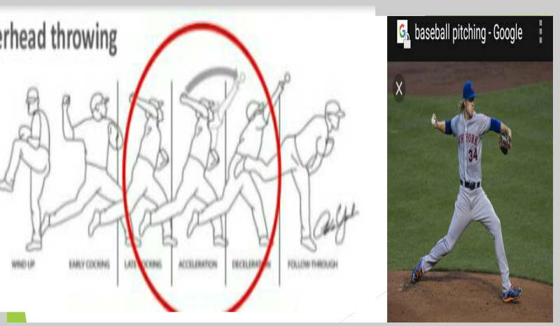 Pathomechanics of elbow joint