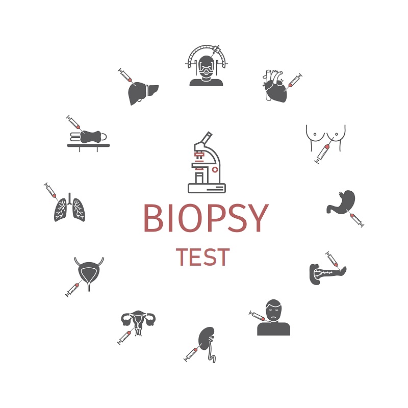 8 Types of Biopsy Test
