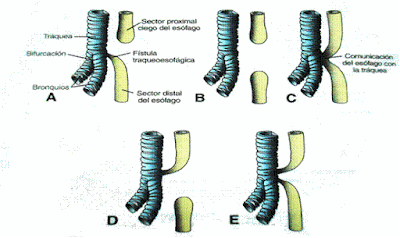 Curso de Anatomía II: Traquea