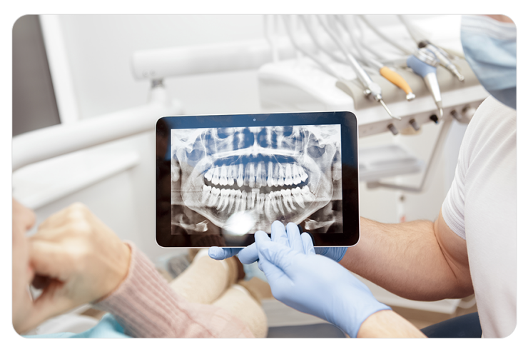 WEBCEPH, why do you need it?