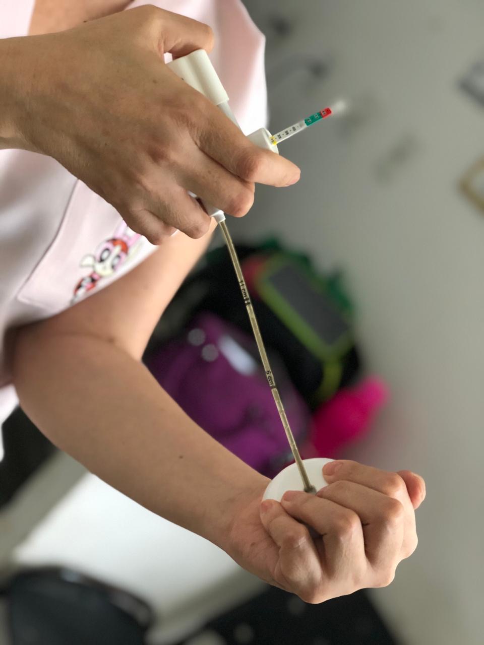 Parto instrumental: fórceps e vácuo-extração na Obstetrícia moderna ...