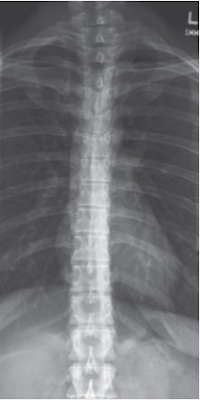 Posicionamento Radiológico - Exame de Raio-X: POSICIONAMENTO ...
