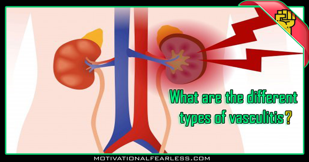 What are the different types of vasculitis? - Motivational Fearless