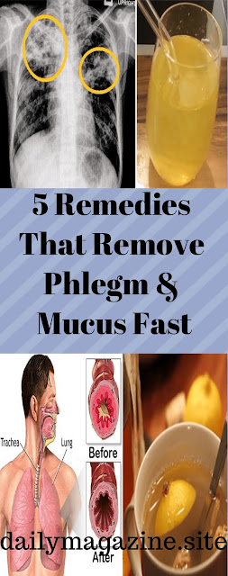 5 Remedies That Remove Phlegm & Mucus Fast - DIY CRAFT PLUS