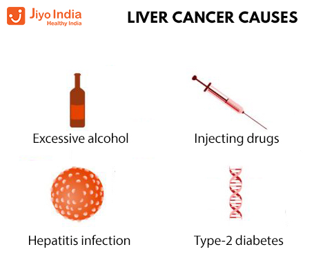 7 Early Liver Cancer Symptoms That Everyone Should Know