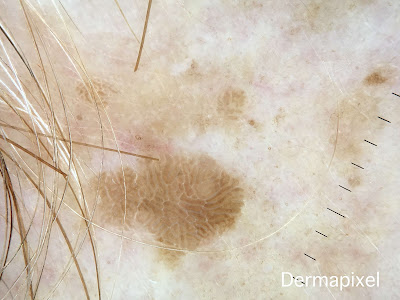 Dermapixel: enero 2020