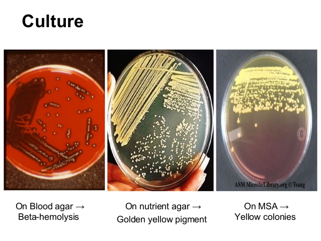 Merlins Micro World: Staphylococcus aureus - Laboratory diagnosis and ...