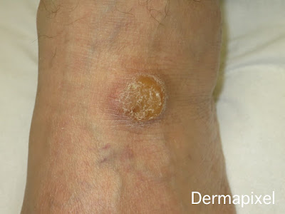 Dermapixel: mayo 2020