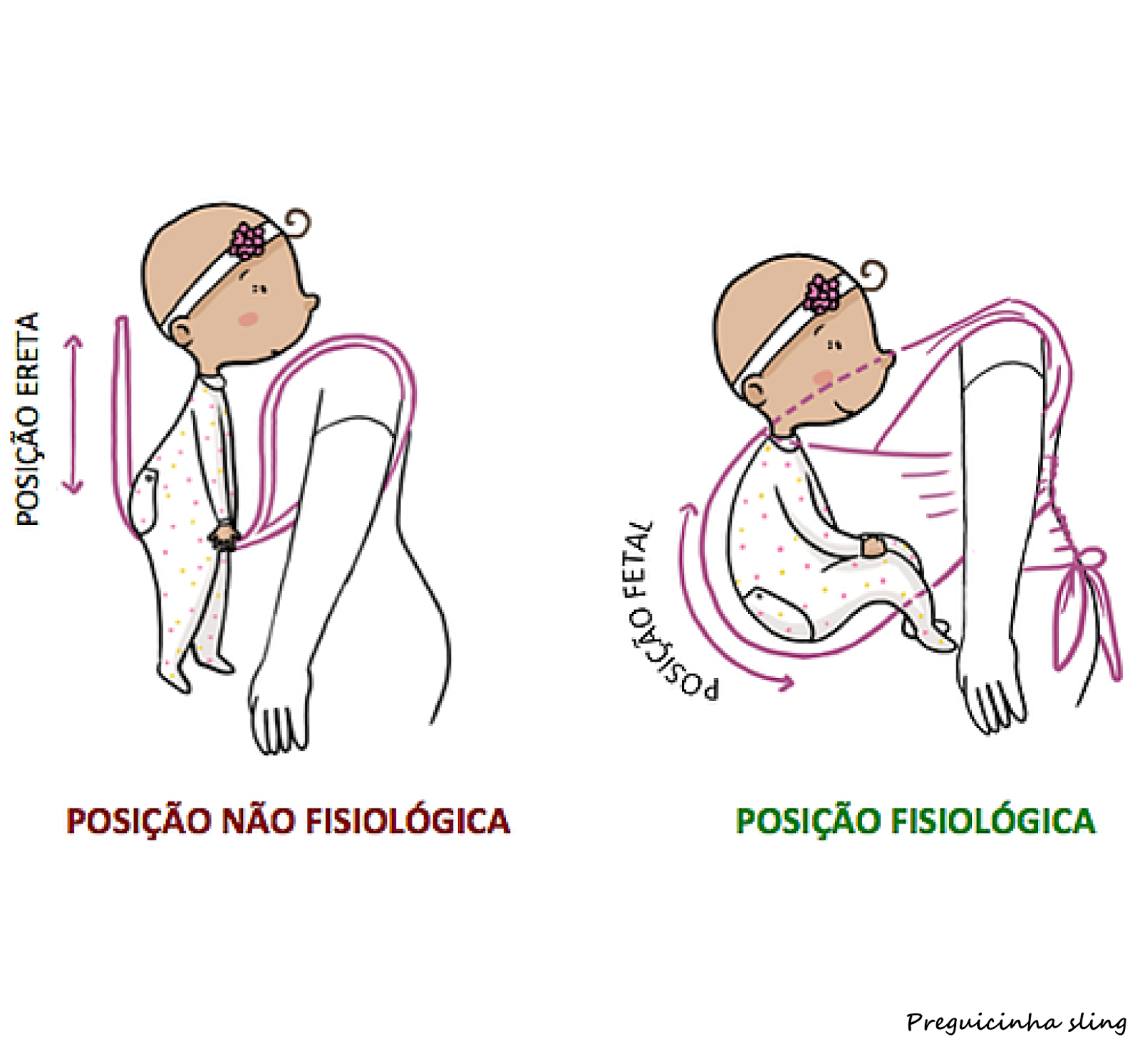 Preguicinha sling: Posição correta para usar wrap sling
