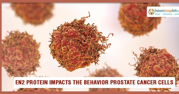EN2 Protein Impacts The Behavior Prostate Cancer Cells