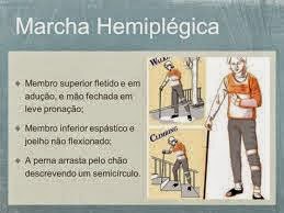 Tipos de Marchas Patológicas - Enfermagem em Ortopedia