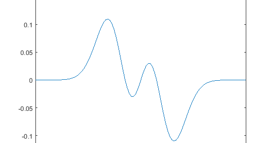 Biomedical Signal and Image Processing projects using Matlab and ...