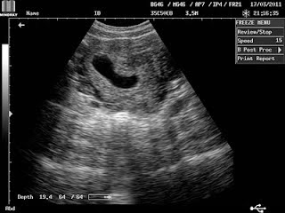 Pemeriksaan Radiologis Penyakit GINJAL | Ilmu Kesehatan Medis