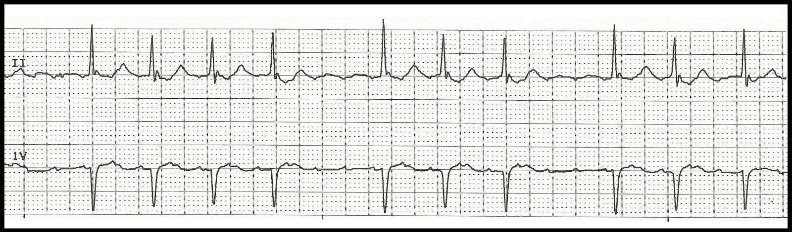 EKG Rhythm Strip Quiz 123