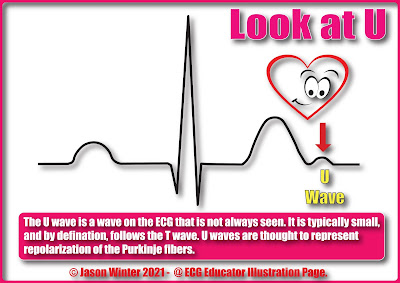 ECG Educator Blog