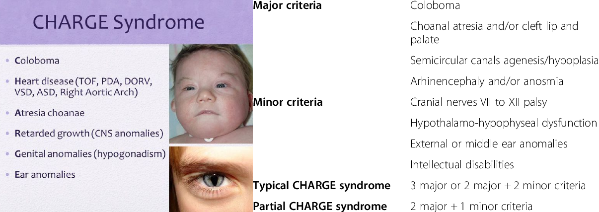 CHARGE Syndrome