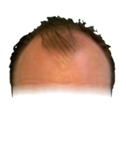 Fotos Para Montagem PNG, Óculos, Cabelos, Chapéu, etc: Imagens PNG Carecas