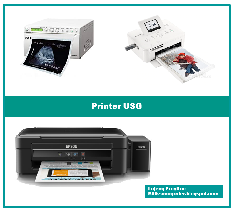 Sejarah Ultrasonografi (USG)