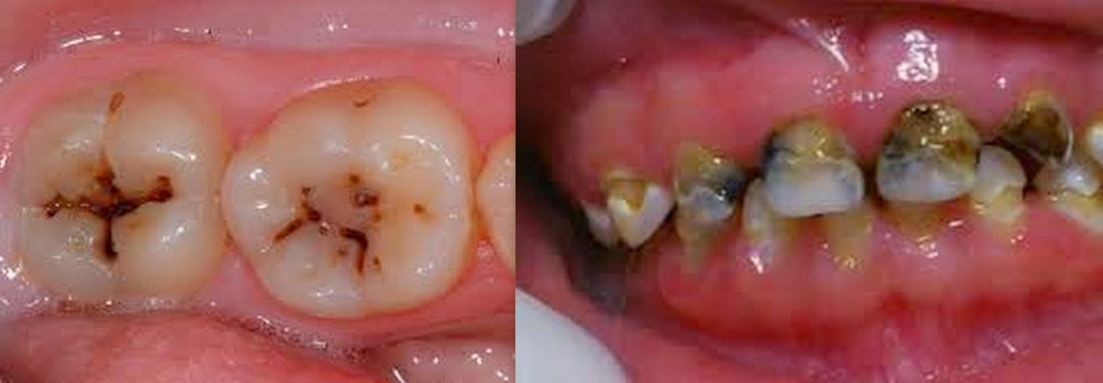 jaitt odonto social: NUTRICION Y SALUD BUCODENTAL