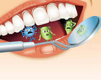 Control de Placa Supragingival: PLACA SUPRAGINGIVAL