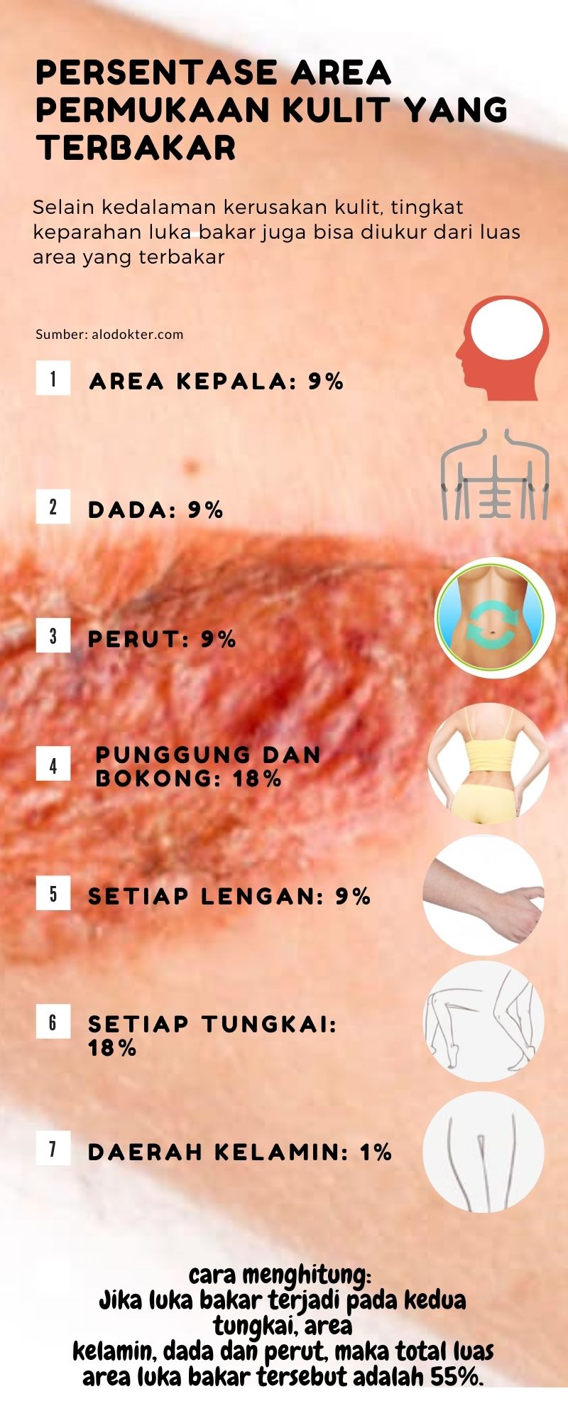 Pengalaman Luka Bakar, Lebih Sakit Dibanding Melahirkan Anak! | Curhat Si Ambu