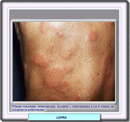 Patología: abril 2012