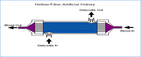 Nursing: HEMODIALYSIS