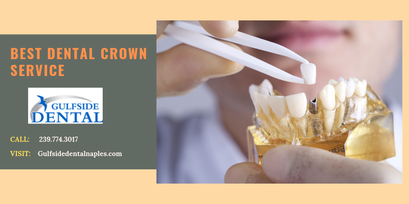 Select Our Best Dental Crown Service