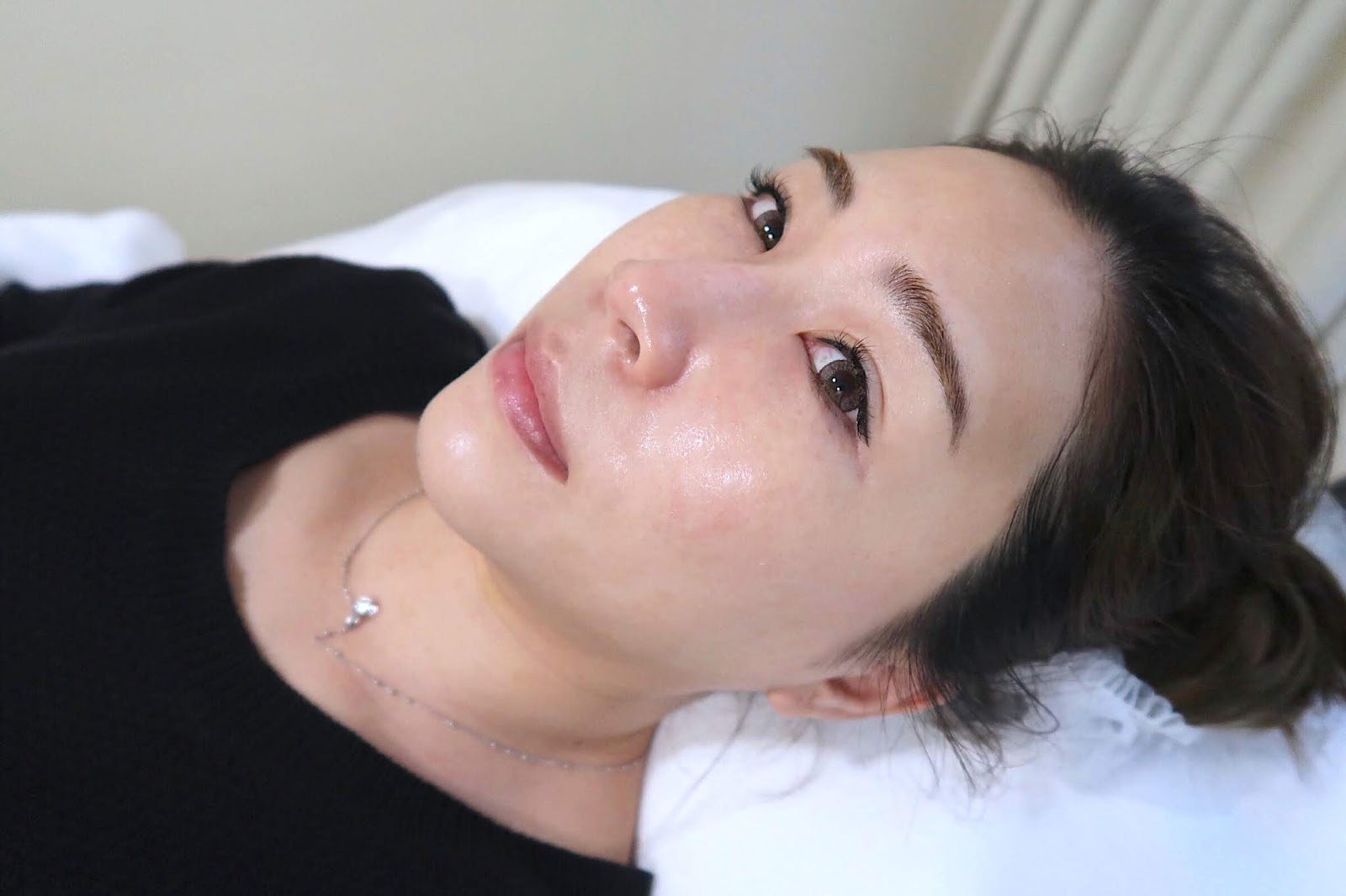 Makeup Secret: 呢個 treatment 真係好顛要試! 唔試後悔! Wiish Derma「等離子細胞再生療程」