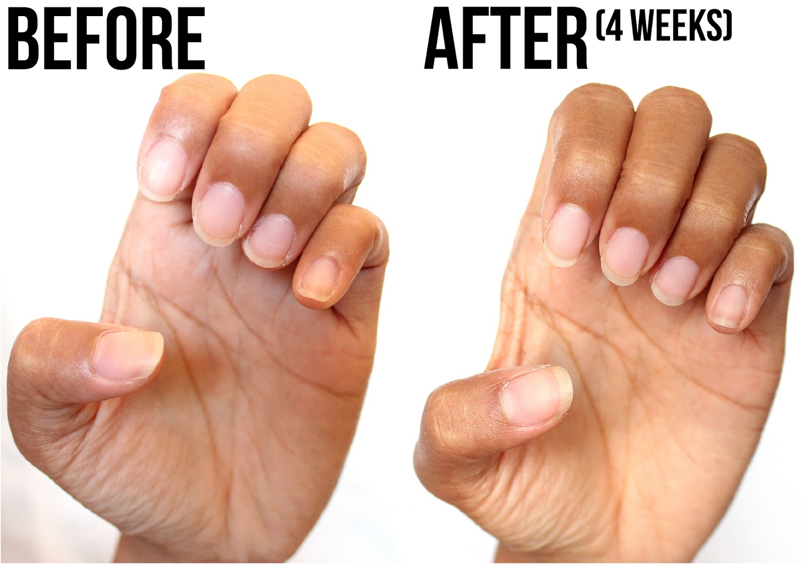 AUTEUR ARIEL: Healthier Nails w/ Nail Medic