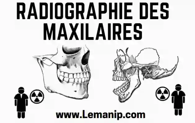 Radiographie Maxilaire (Machoire )