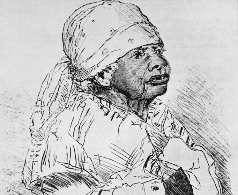 Noticia Sigatoka Venezuela: LA NEGRA MATEA