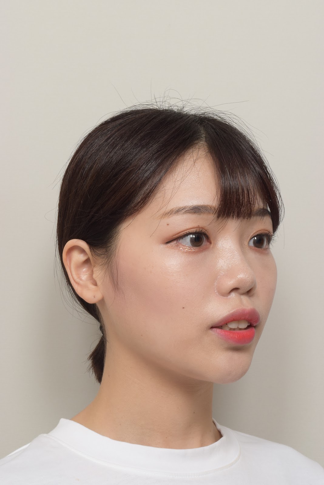 Anterior Segmental Osteotomy (ASO) Surgery _ EU