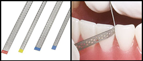 Sneek's Invisalign Treatment: My Interproximal Reduction (Shaving Tooth ...