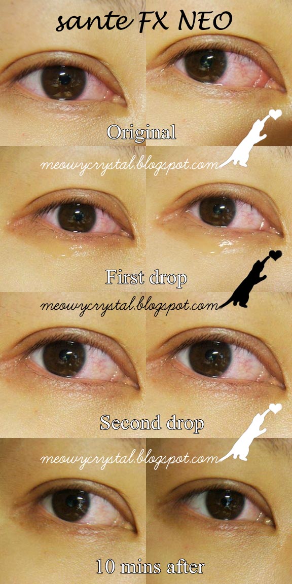 meowycrystal: Santen 參天 sante FX NEO eye drop review