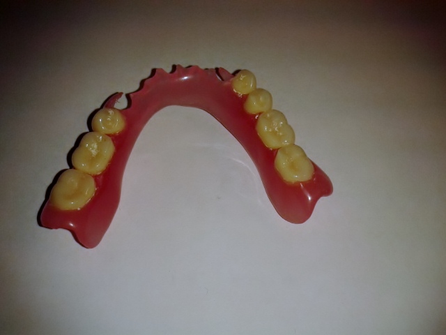 Prótesis dentales: Prótesis flexibles TCS Iflex o Partial Flex