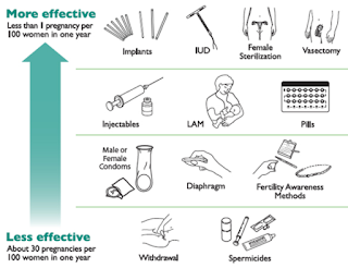 About 12 Women's Contraception Birth Control Devices (IUD Injection ...