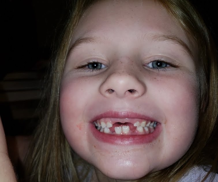 The REAL Messy Mom: Teeth is a Messy Business