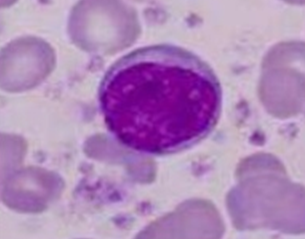 Atlas de Células Sanguíneas : septiembre 2014